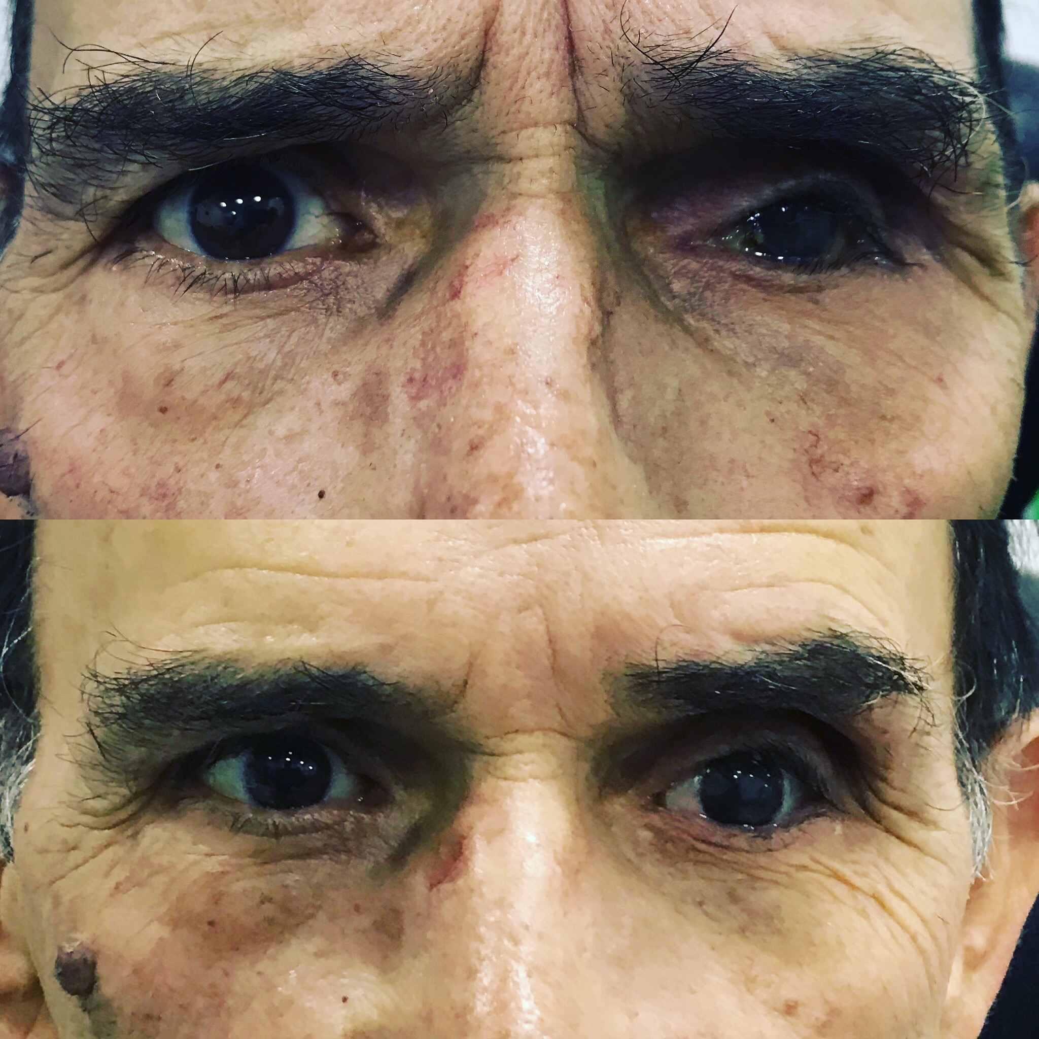 Protesis Personalizadas – Prótesis Oculares López